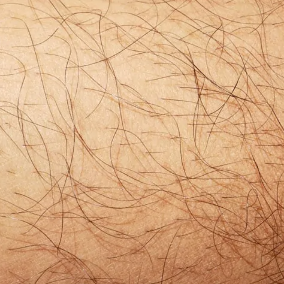 Huidprobleem - Ongewenste haargroei - Huidzorg West